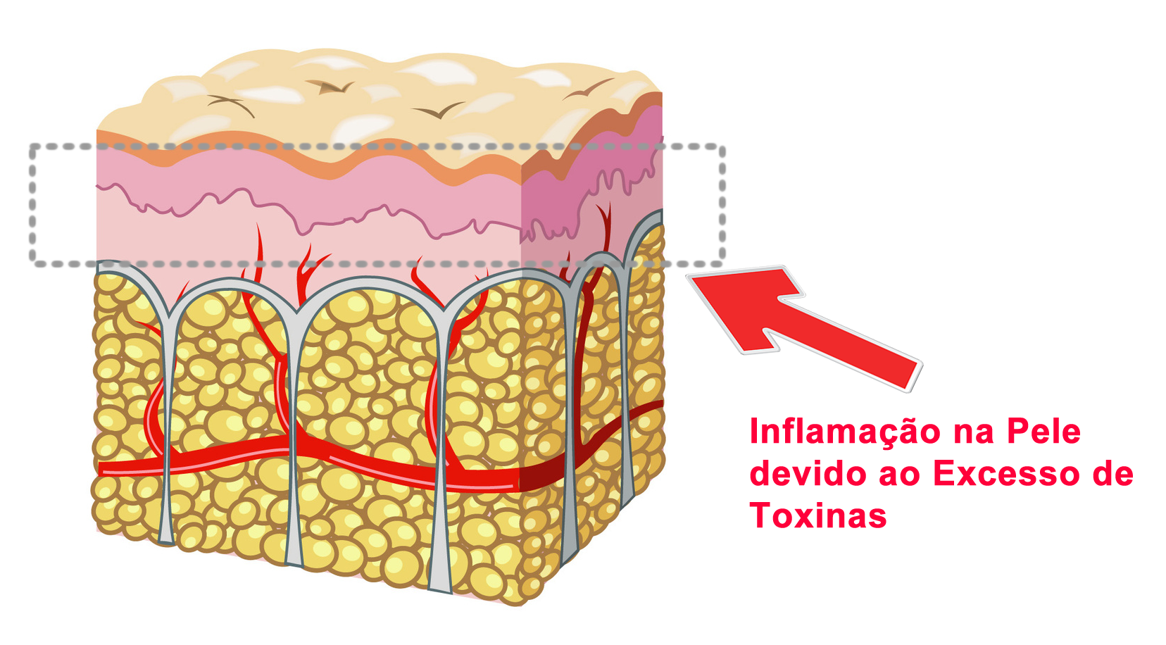 Adeus Celulite – Tenha Pernas Lisas - Mulher em Forma
